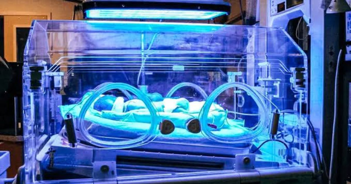 Kenali Penyebab Bayi Kuning dan Cara Pencegahannya!